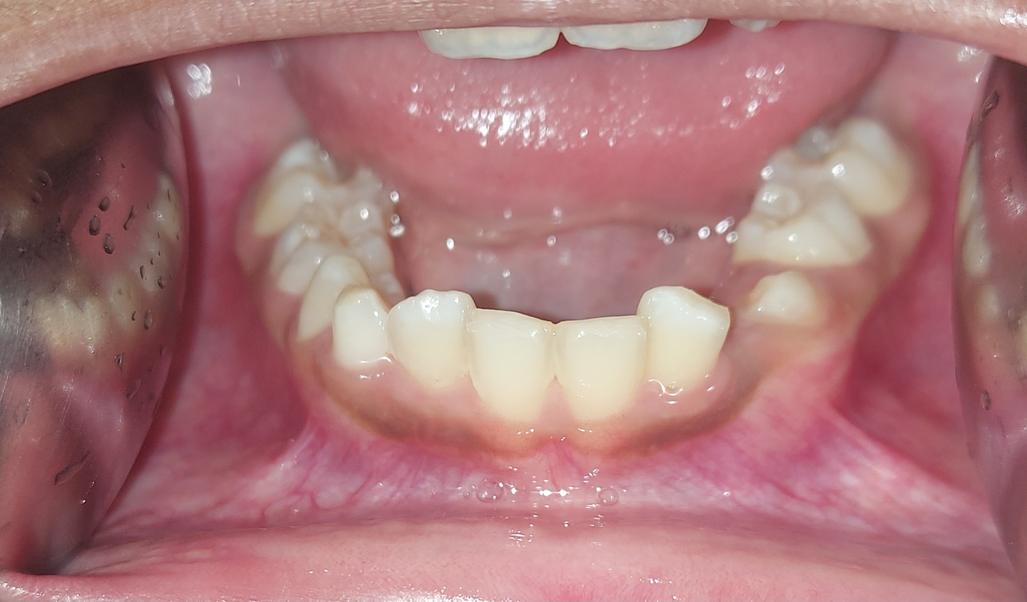 Welcome to Dr. Naidu’s Virtual Dental Consult – Dr Naidu's Dental ...